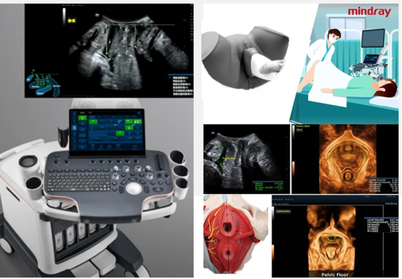 Dubens dugno raumenų funkcijų vertinimas - Antalgija